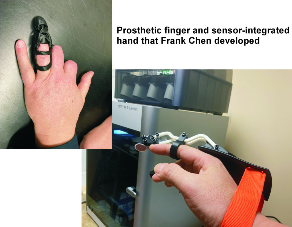 Smart Prosthetic Hands for Enhanced Living - Ingenious+
